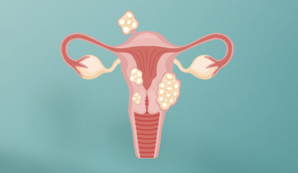 El Parc Taulí incorpora el retractor bucal para cirugía transoral FK-WO ...